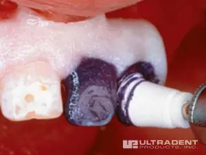 E-Dental Mart | Opalustre