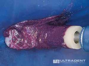 E-Dental Mart | Opalustre