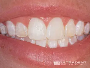E-Dental Mart | Opalustre