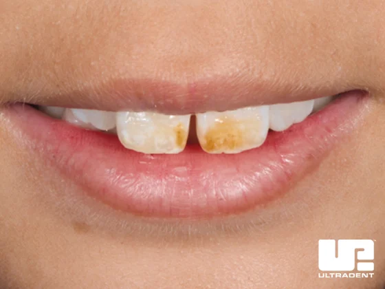 E-Dental Mart | Opalustre