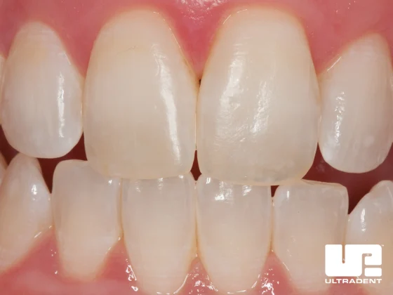 E-Dental Mart | Opalustre