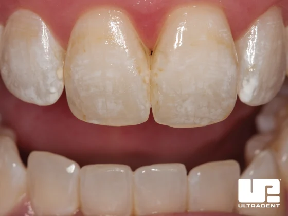 E-Dental Mart | Opalustre